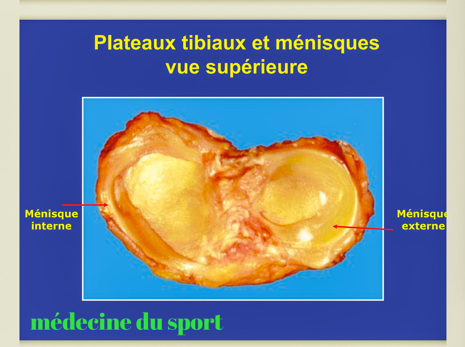 Pathologies des ménisques (part 1)