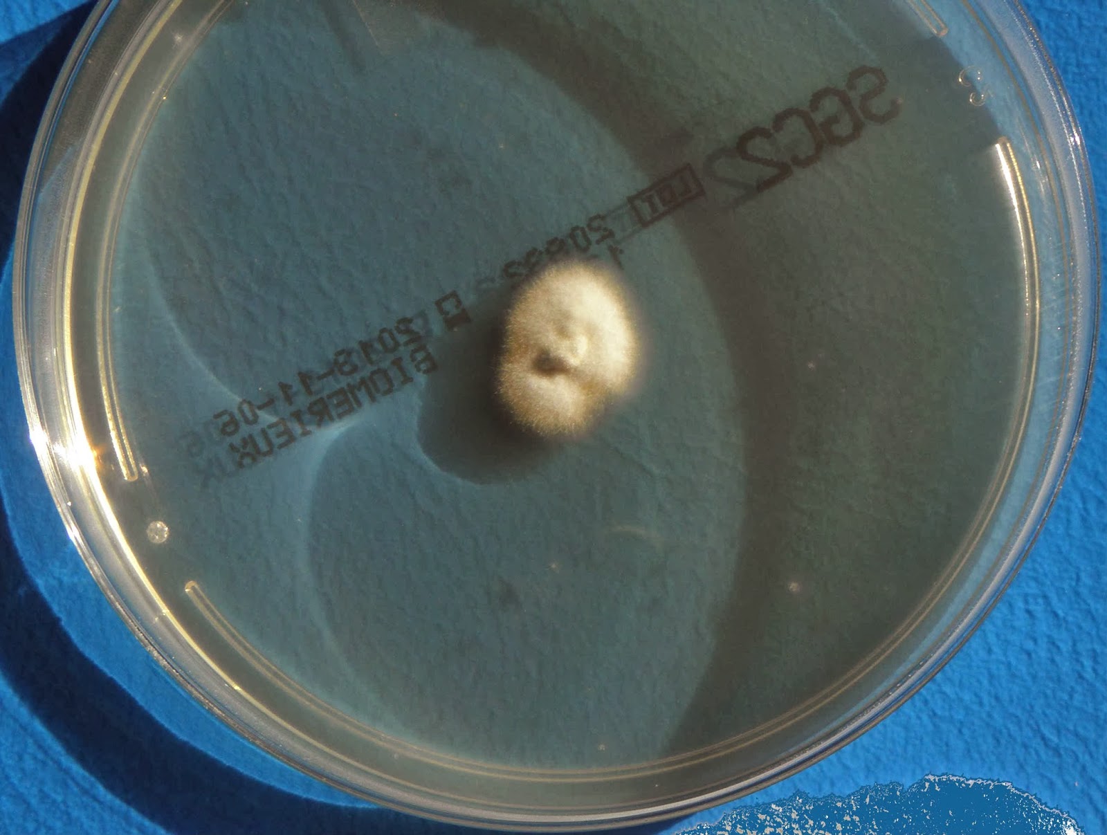 ATLAS MICOLOGIA: TRICHOPHYTON VERRUCOSUM