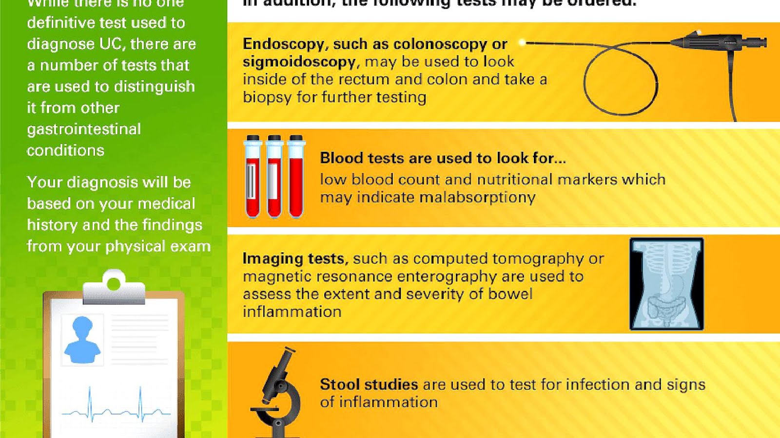 Ulcerative Colitis Diagnosis - Ulcer Choices