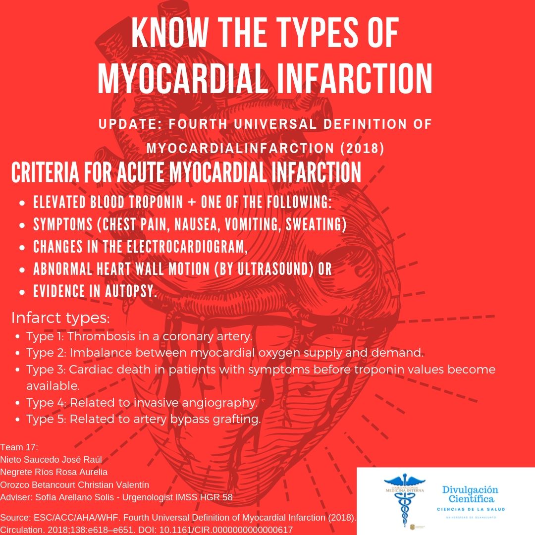 Know the types of myocardial infarction. - DIVULGACIÓN CIENTÍFICA UG