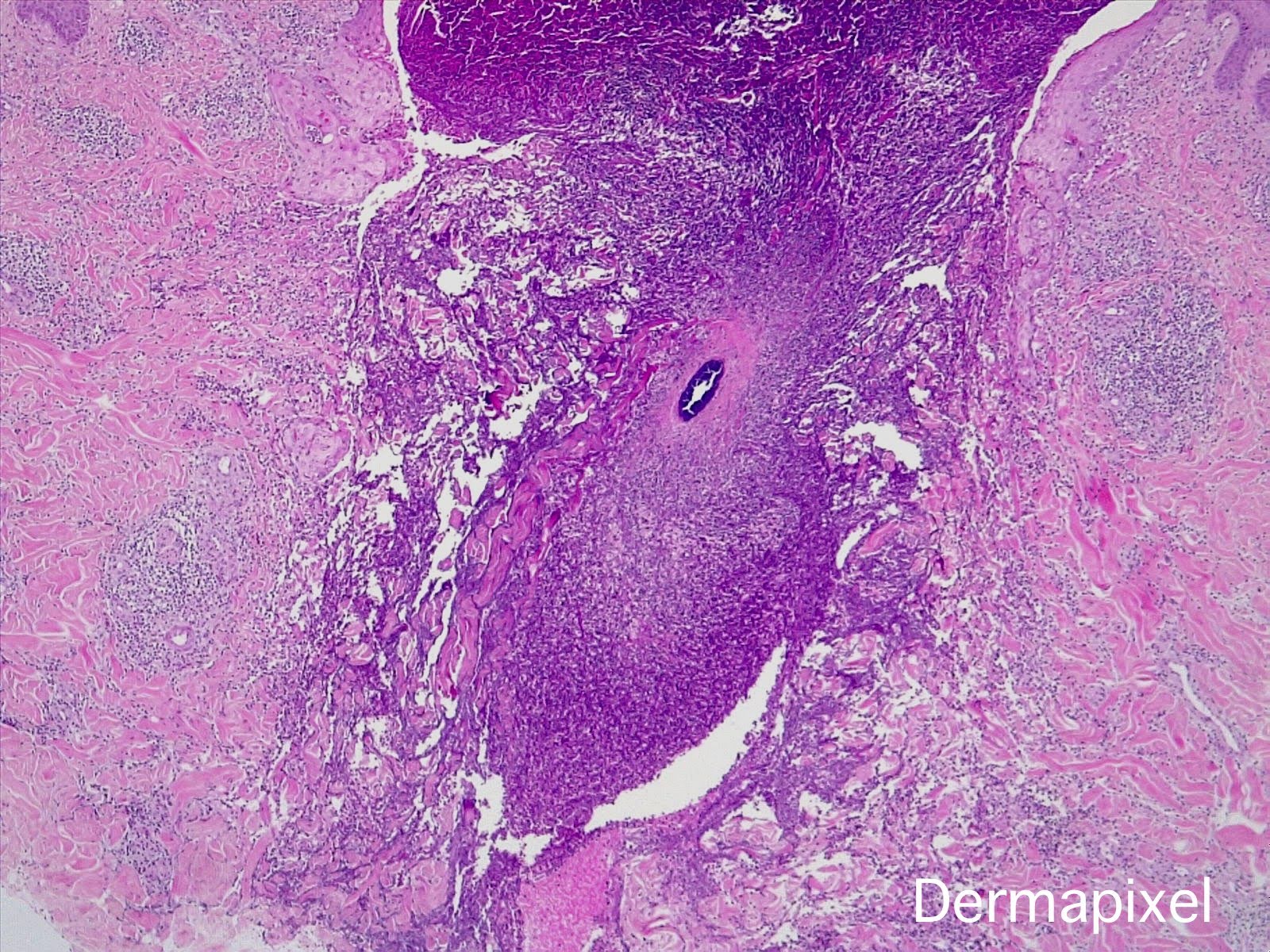 Dermapixel: abril 2020