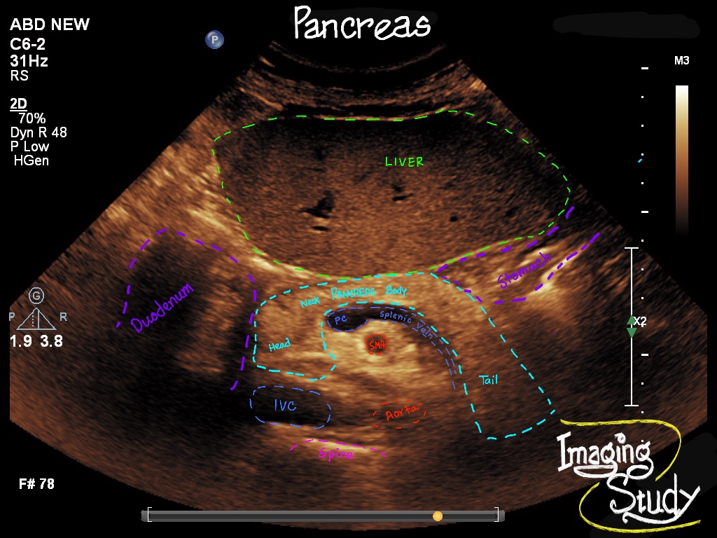 Imaging Study: Pancreas Ultrasound Anatomy