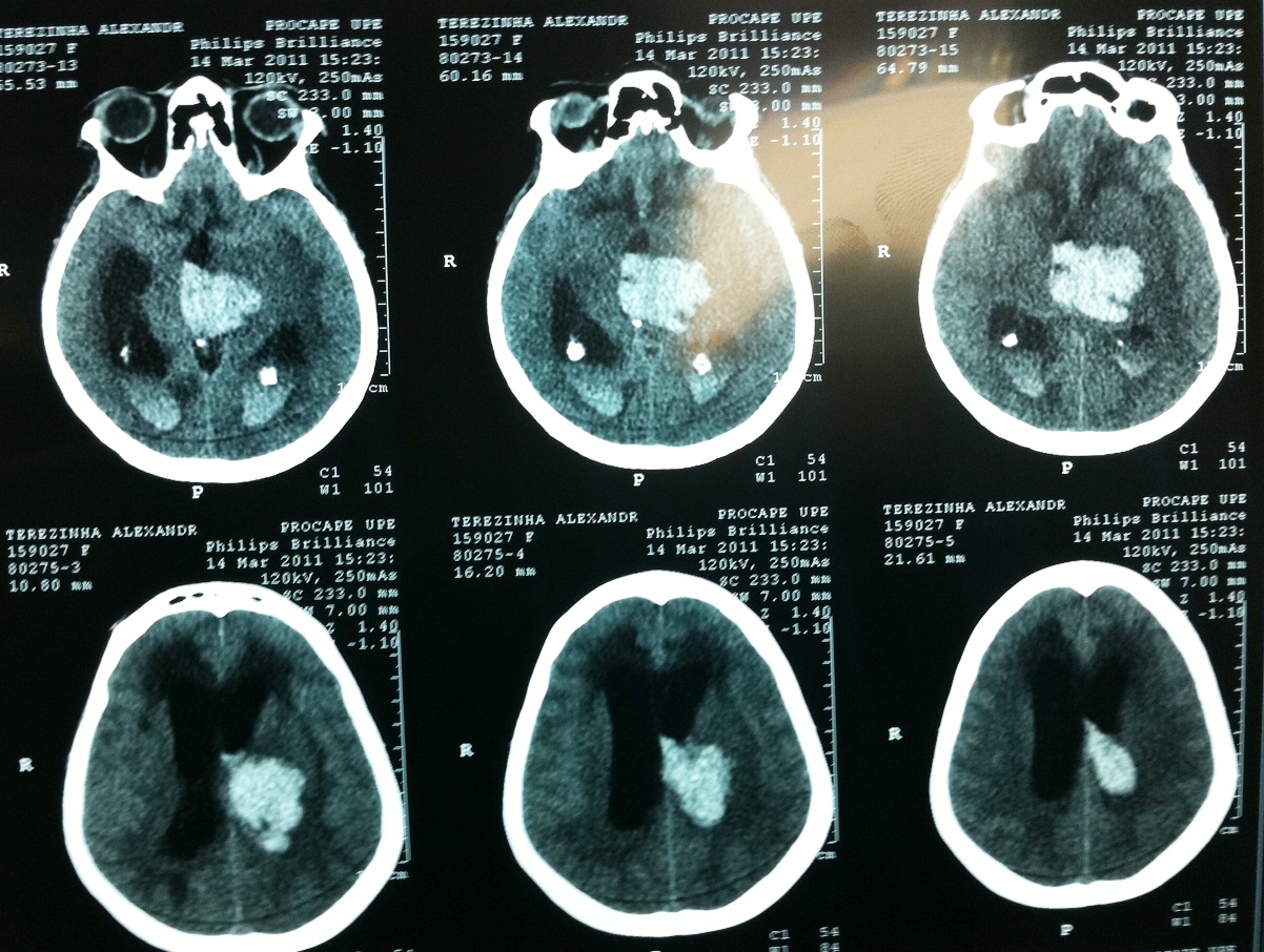 Núcleo de Estudos em Cardiologia on line (Cardios On line): Fórum de ECG