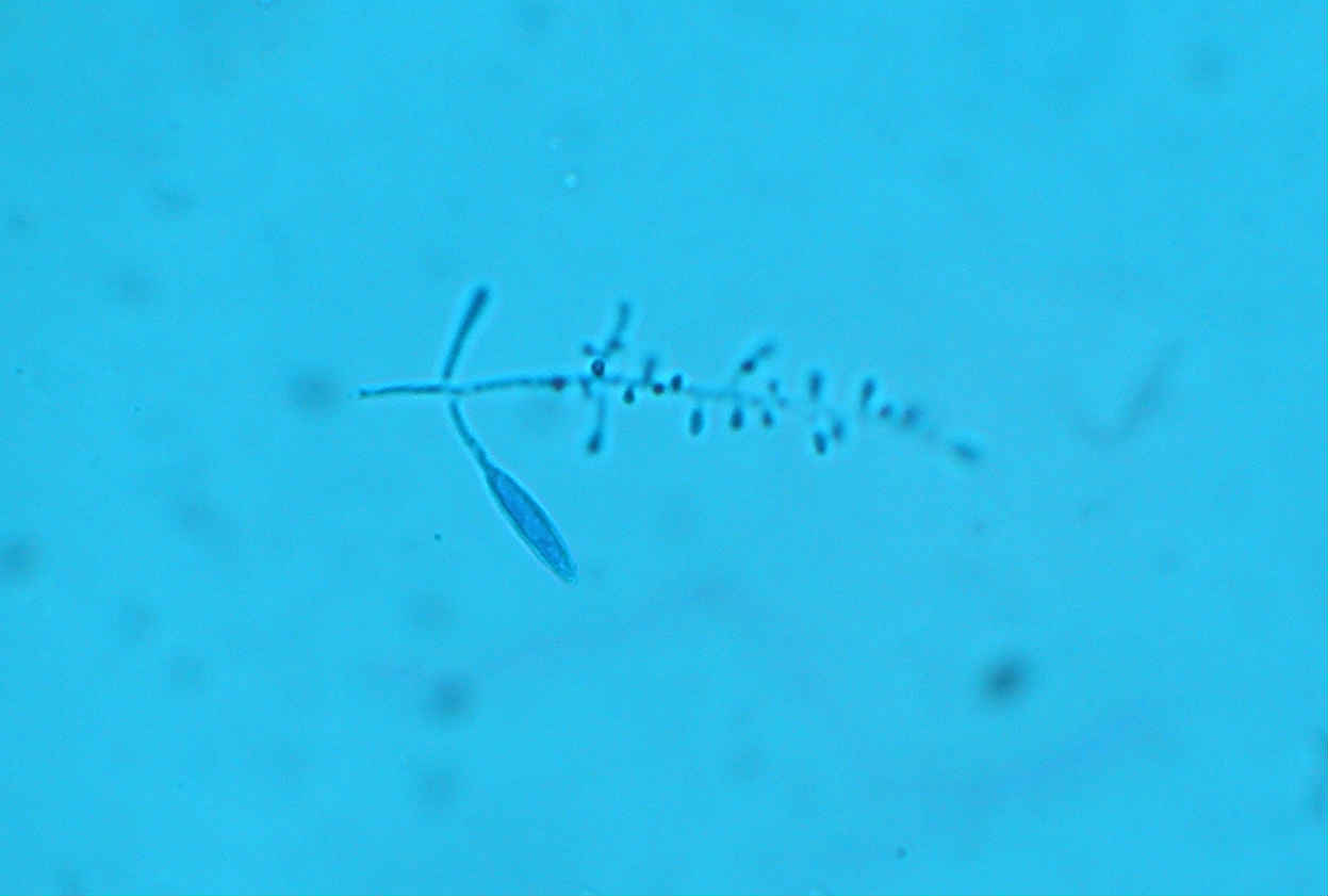 ATLAS MICOLOGIA: MICROSPORUM GYPSEUM