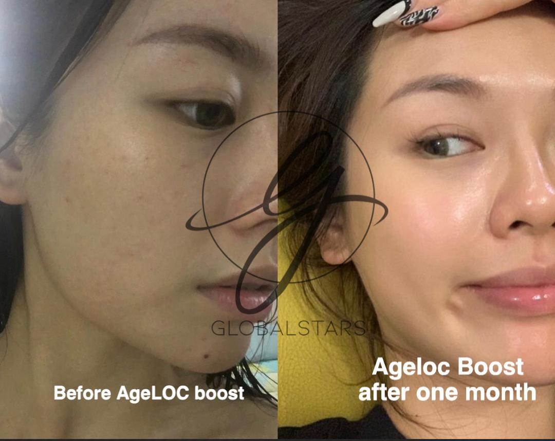 ageLOC Boost - Worth The Hype? Personal Review | ♥Miriam MerryGoRound♥