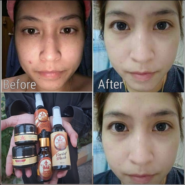 RATU SOLO SKINCARE - Ratu Solo Skincare
