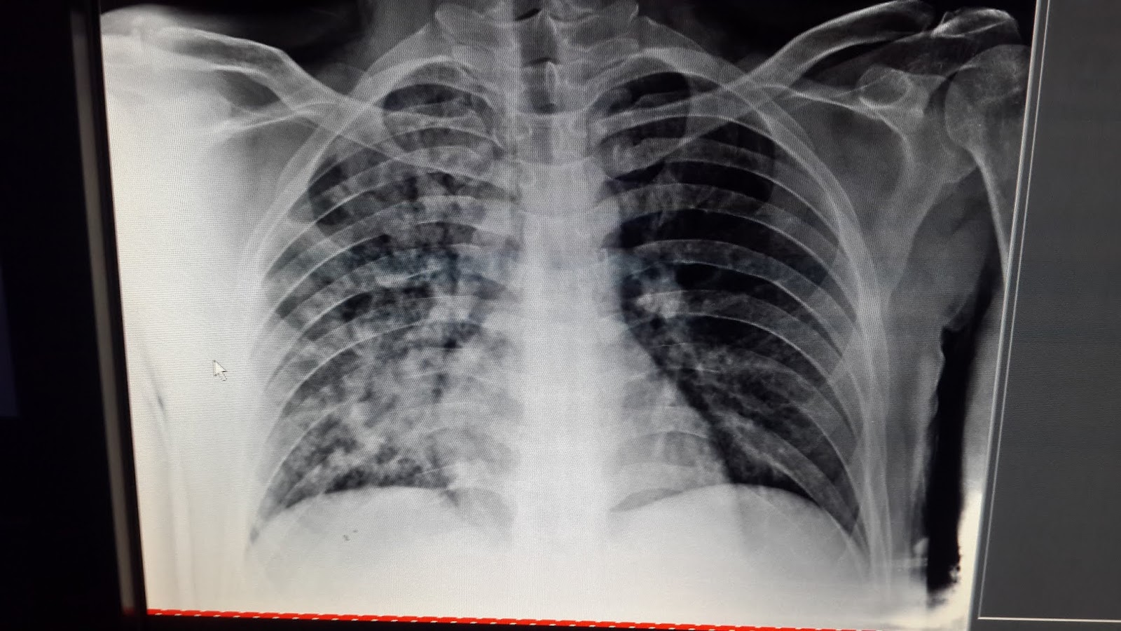 EL RINCÓN DE LA MEDICINA INTERNA. juanpedromacaluso@yahoo.com.ar ...