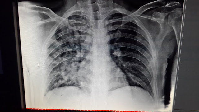 EL RINCÓN DE LA MEDICINA INTERNA. juanpedromacaluso@yahoo.com.ar ...