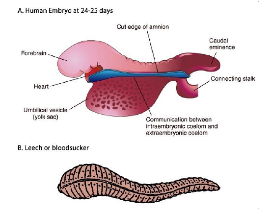Embryology in the Qur’ān: External appearance of the embryo as a Leech