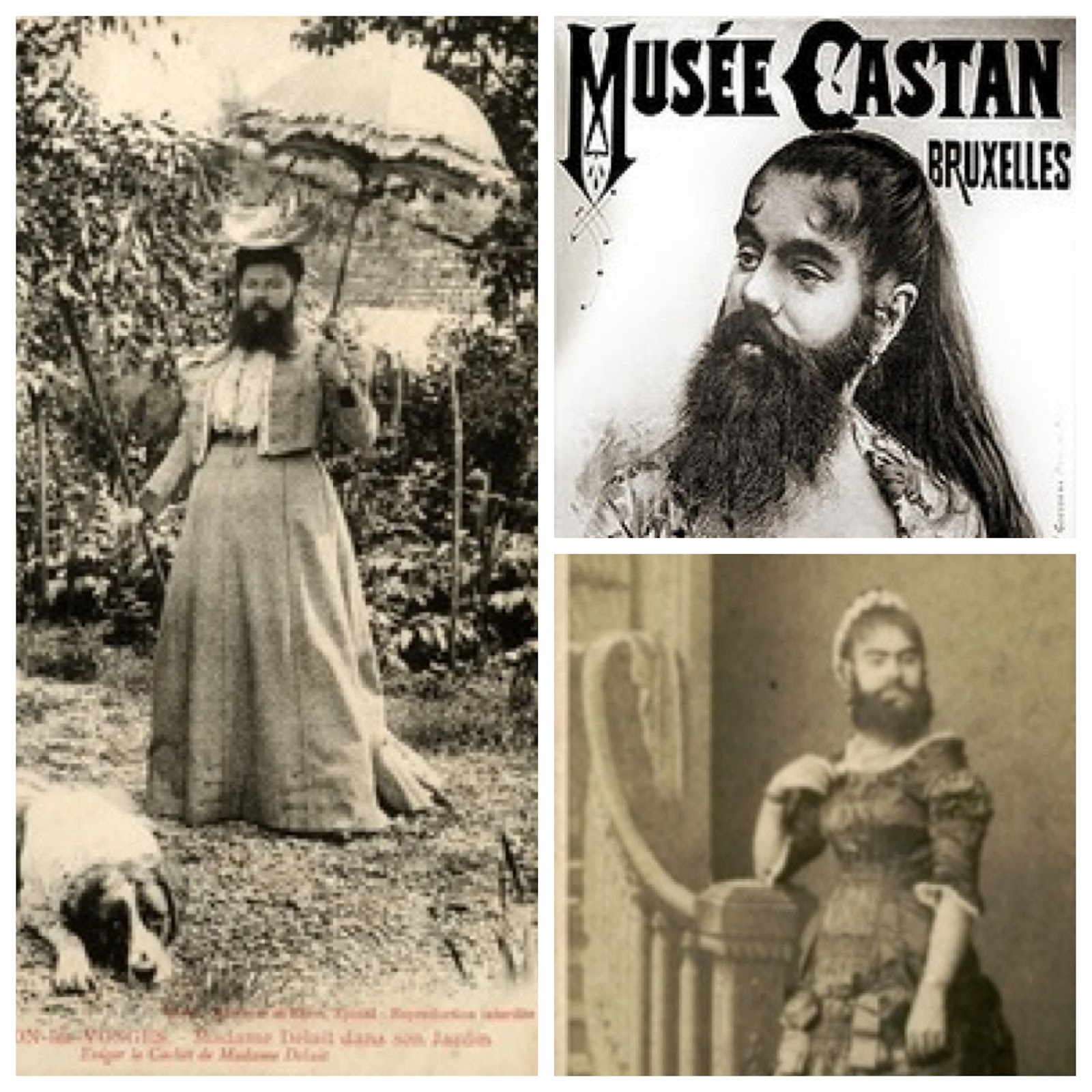 clsterfck: Bearded lady.