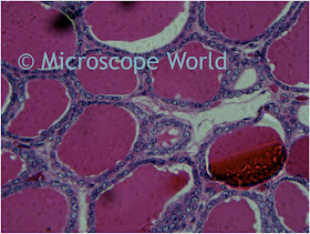 Microscope World Blog: Tonsils under the Microscope