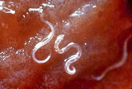 ON THE SPOT - Cacing-Cacing Berbahaya yang Ada di Tubuh Manusia