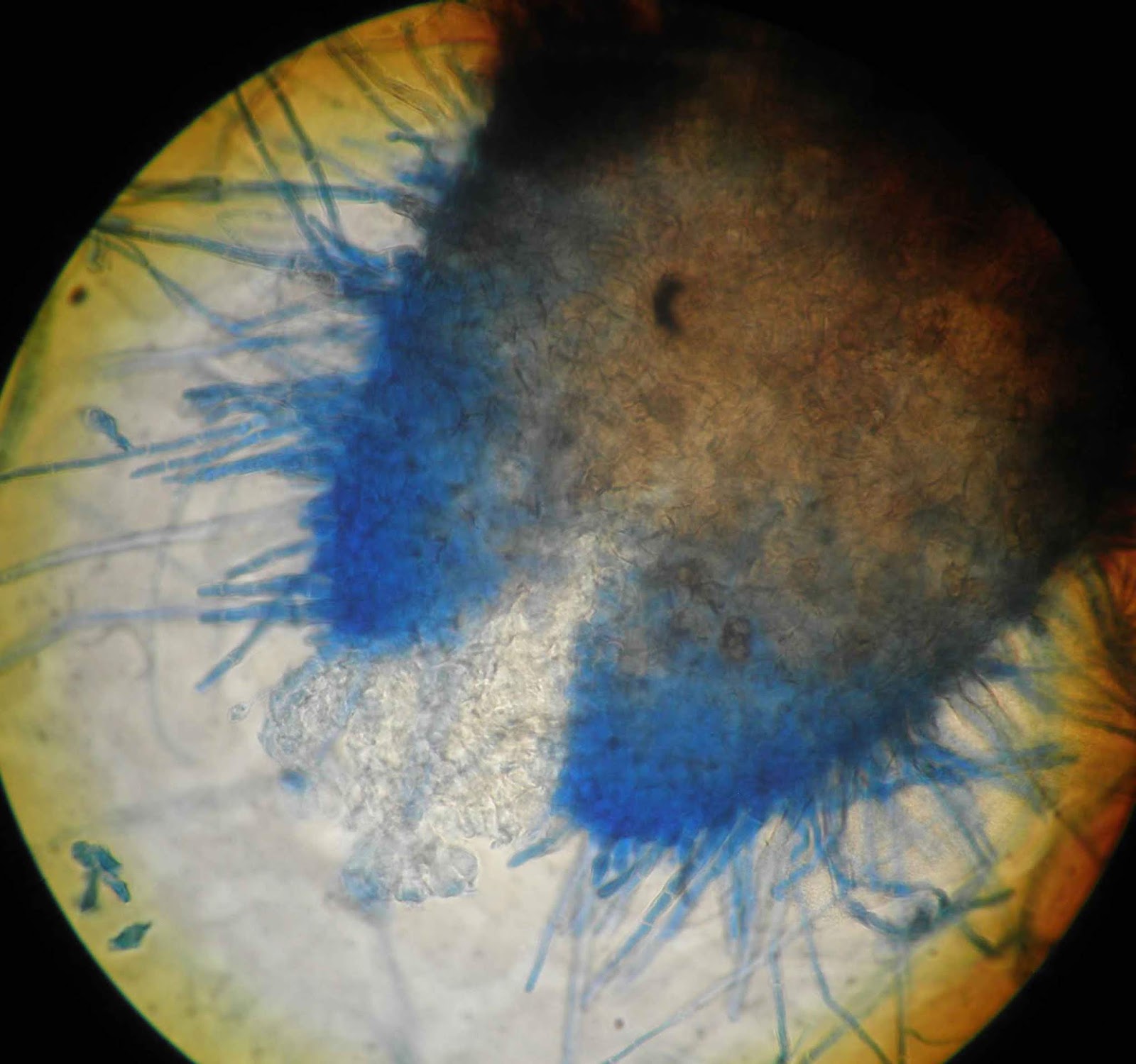 ATLAS MICOLOGIA: CHAETOMIUM SPECIES