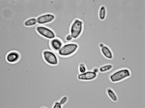 Platypus Sommelier: Brettanomyces (Brett)