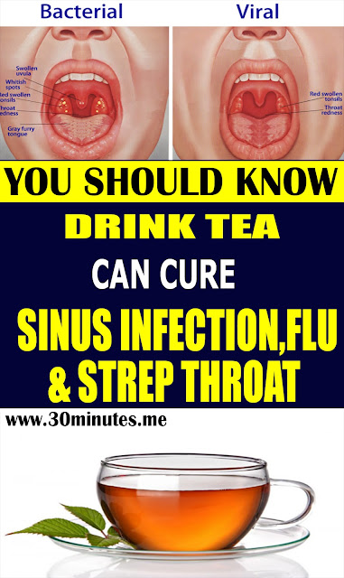 The tea that cures sinus infections,strep throat and flu - HEALTH and ...