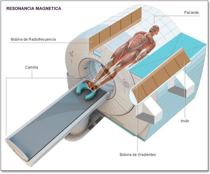 ¿Cómo funciona la Resonancia Magnética? - Kenza