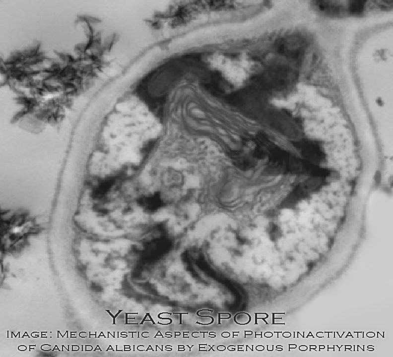 peaceful parenting: Yeast, Rash and Redness: Breastmilk Spurs Yeast ...