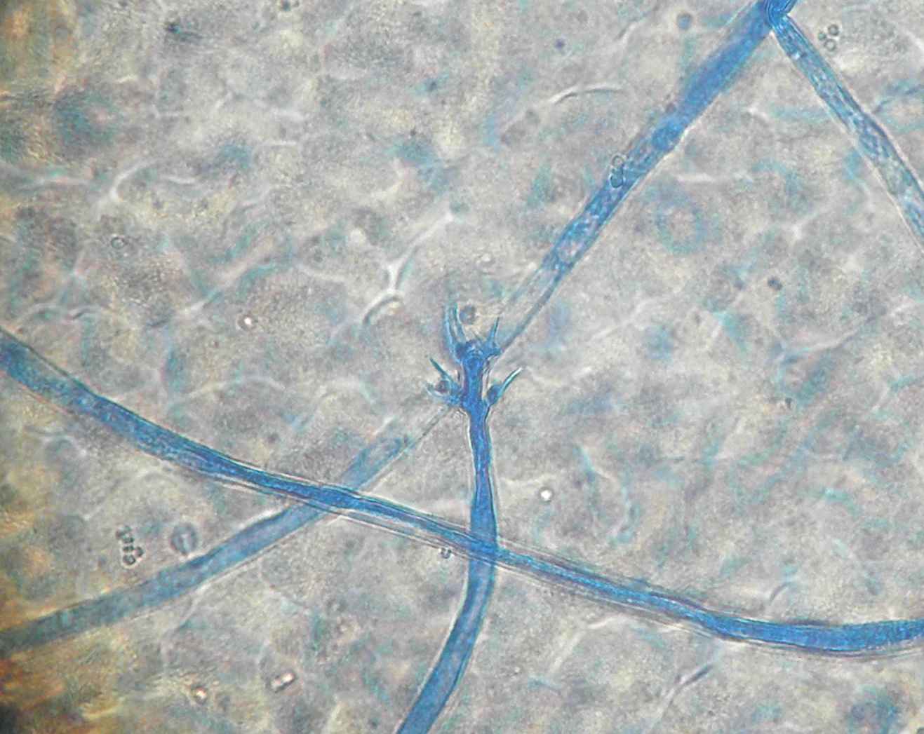 ATLAS MICOLOGIA: SYNCEPHALASTRUM RACEMOSUM