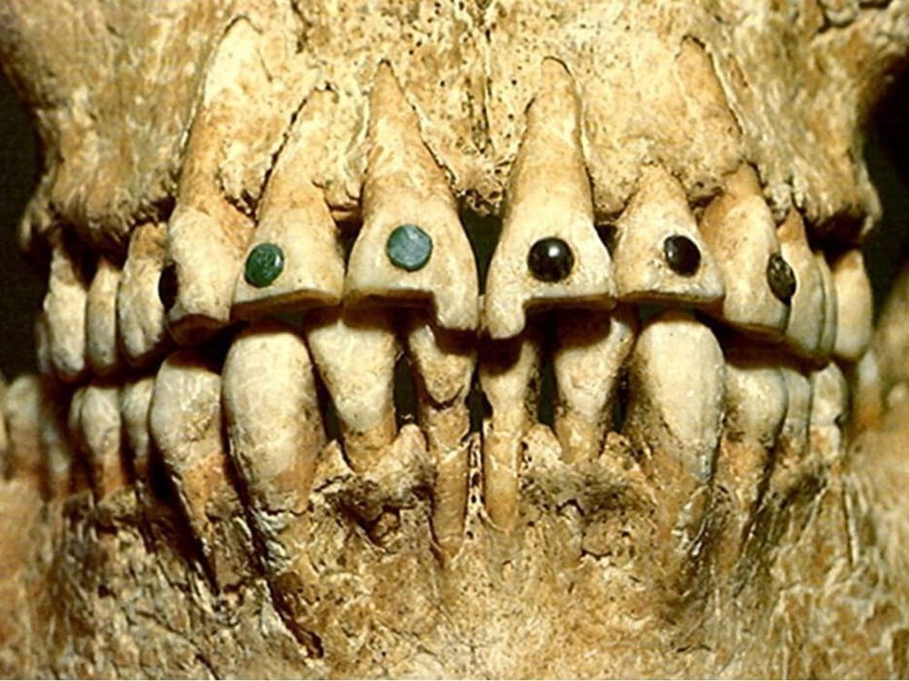 The Mayans Used to Decorate Their Teeth by Place Carved Stone Inlays ...
