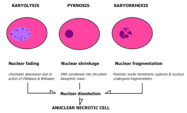 Lecture Notes in Medical Technology: Lecture #2: Mechanism of Cell Damage