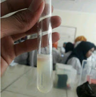 Praktikum Biologi: Uji Kualitatif Protein