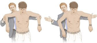 Dear Joyce: Hope for Stroke-Paralyzed Arm?