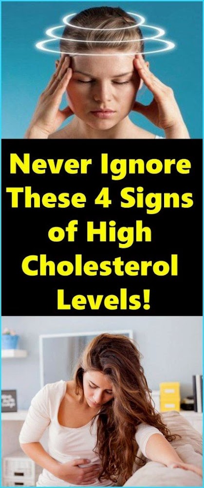 10 Symptoms of High Cholesterol That You Shouldn’t Ignore - wellness ...