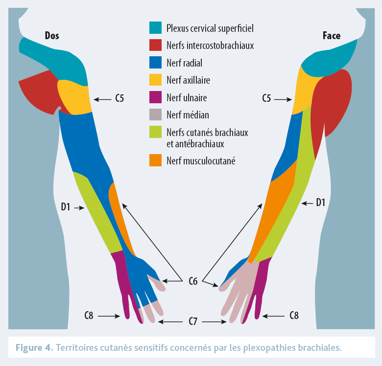 Electroneuromyographie: Evaluation ENMG du Plexus Brachial