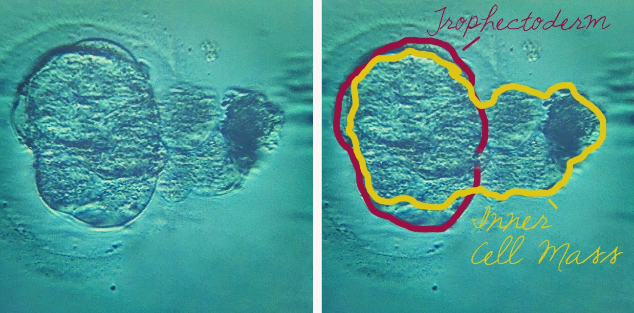 Sunshine and Snowflakes: Embryology 101 and Baby's First Photo and ...
