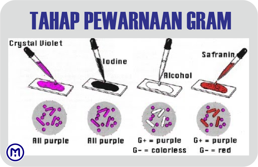 Jurnal Pewarnaan Bakteri Gram Positif Dan Negatif Pdf - Homecare24 Jurnal Pewarnaan Bakteri Gram Positif Dan Negatif Pdf - Homecare24