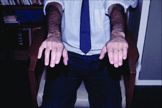 Online blended Medicine assignment (may)