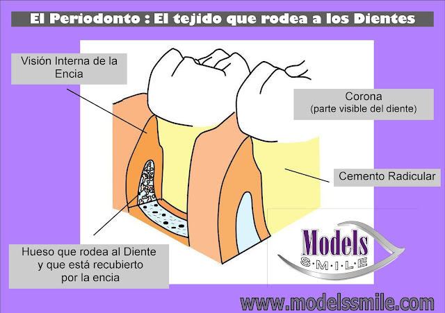 Dientes Flojos: Qué es la Enfermedad Periodontal?