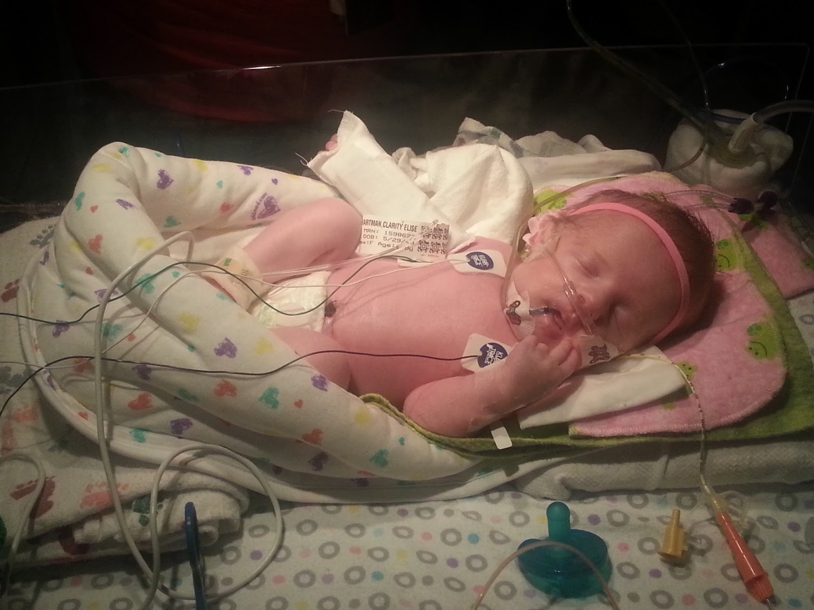 Modern Crafter: Day 20 NICU - Extubation!