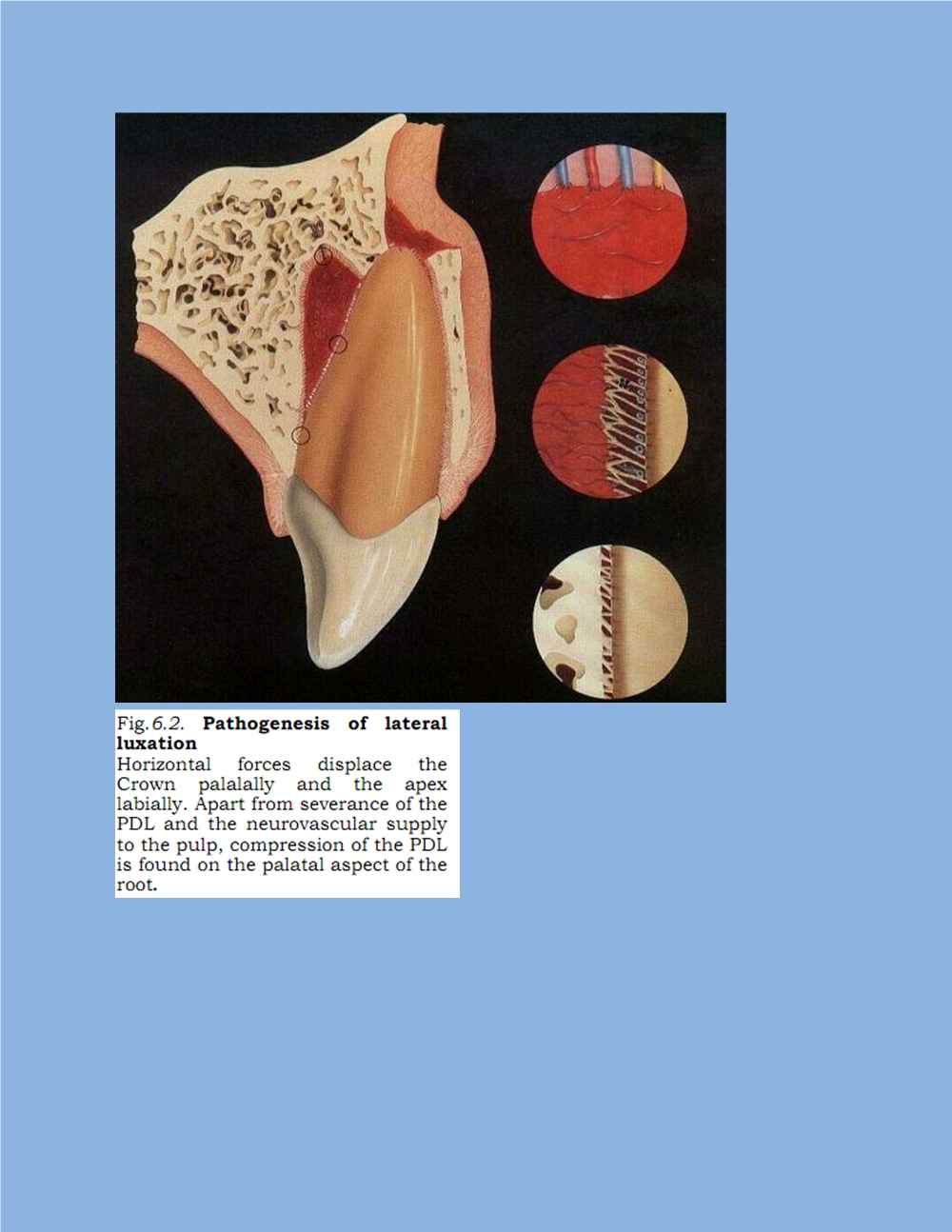 DOs and DONTs in DENTISTRY: CONCUSSION ,SUBLUXATION,EXTRUSION ,LATERAL ...