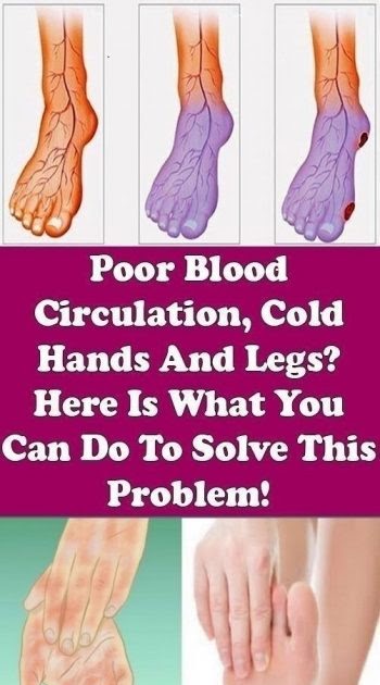 POOR BLOOD CIRCULATION, COLD HANDS AND LEGS? HERE IS WHAT YOU CAN DO TO ...