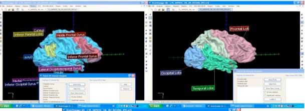 Neuroimaging Made Easy : Brainvoyager QX tips and tricks 1; Some ...