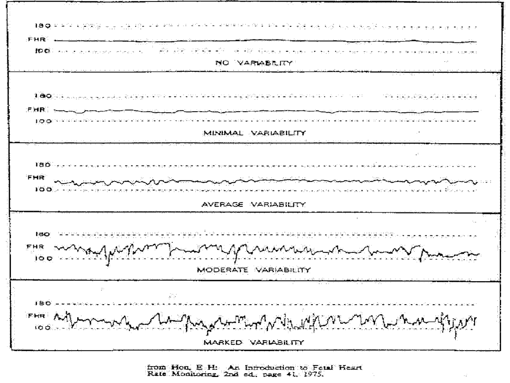Mbbs, BDS, B-Pharma Notes: Methods of Assessing Fetal Status