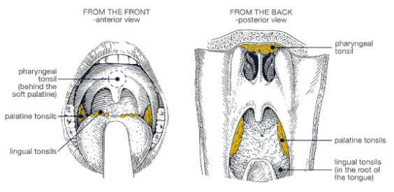 Tugas Sampah Koas: THT-TONSILITIS KRONIK