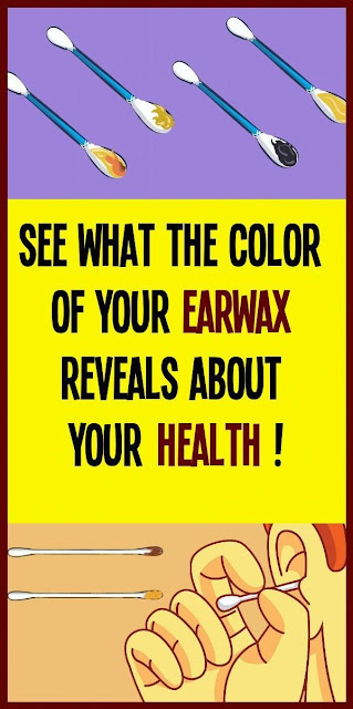 See What The Color Of Your Earwax Reveals About Your Health ...