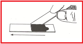 * Focus a thin area under oil immersion and observe the unstained cells ...