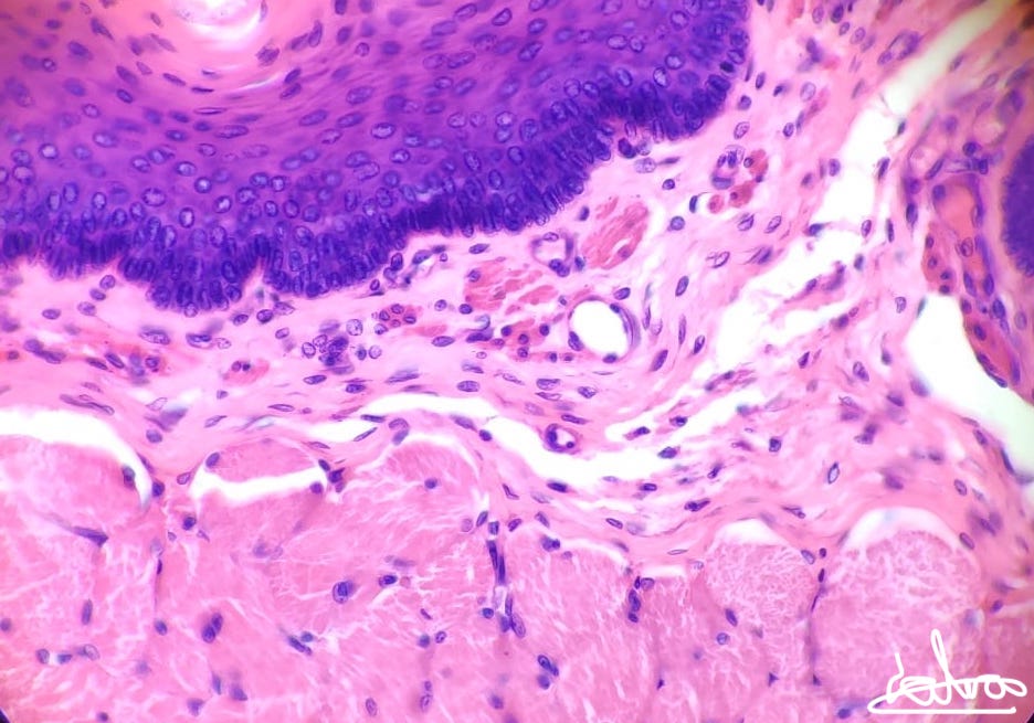 ANATOMÍA PATOLÓGICA Y CITODIAGNÓSTICO: IMÁGENES MICROSCOPIO 2