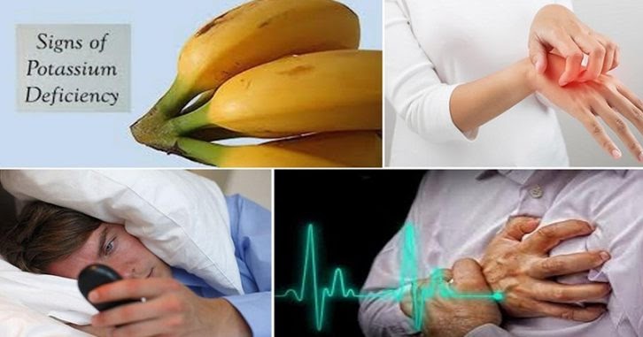 9 Symptoms of Low Potassium Levels in Your Body that You Should Not ...