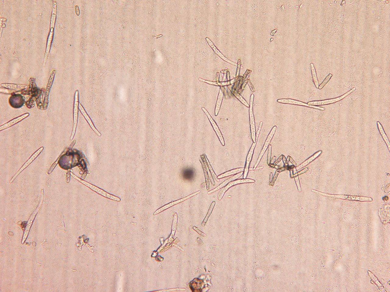 University of Illinois Plant Clinic: How We Identify Corn Leaf Diseases ...