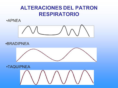 La enfermería y el conocimiento sobre las Alteraciones de la Respiración.