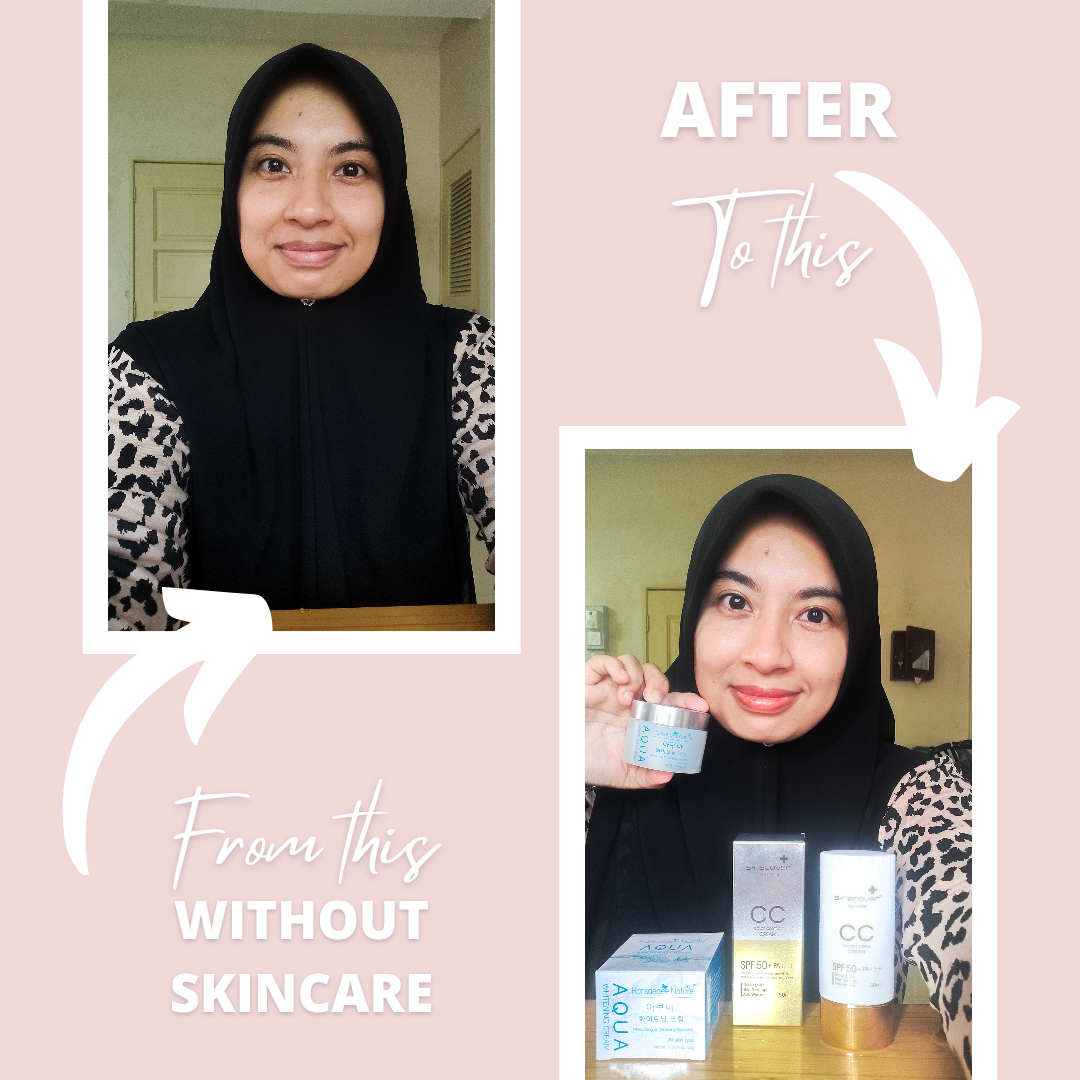 DUA LANGKAH MUDAH UNTUK RAWATAN KULIT KERING DAN BERJERAGAT - Ardini ...