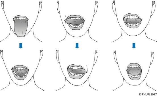 Medical information: TONGUE BASE STRENGTHENING EXERCISE
