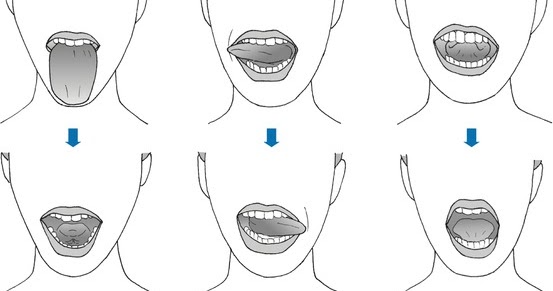 Medical information: TONGUE BASE STRENGTHENING EXERCISE