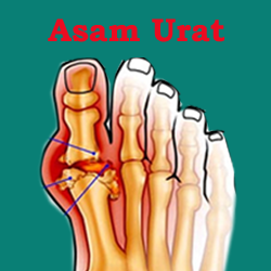 10 Cara Mengontrol Mengendalikan Kadar Asam Urat Alami | Game Learn