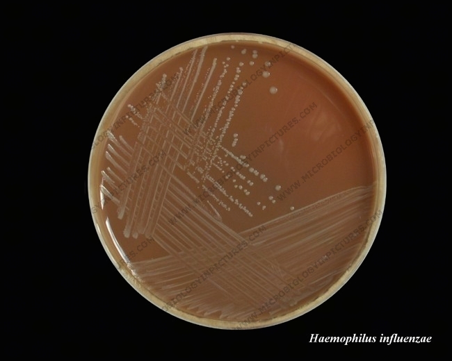 Bug Blog: Lab 5: Burn and Eye Specimens