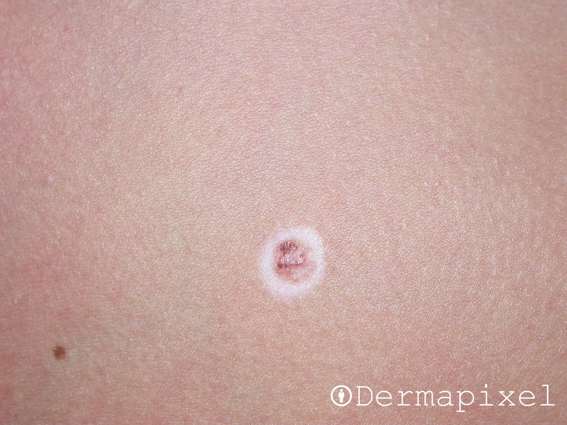 Lunar Blanco En La Cara